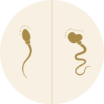 How to read a semen analysis report | Legacy