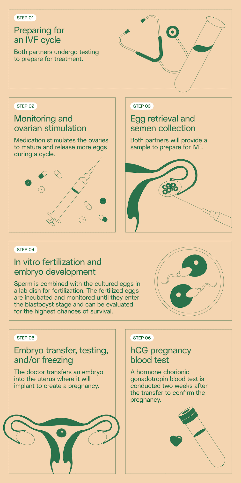 In vitro fertilization: IVF, what is it and who’s a good candidate?