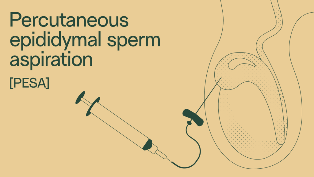 Testicular sperm retrieval options — male fertility | Legacy