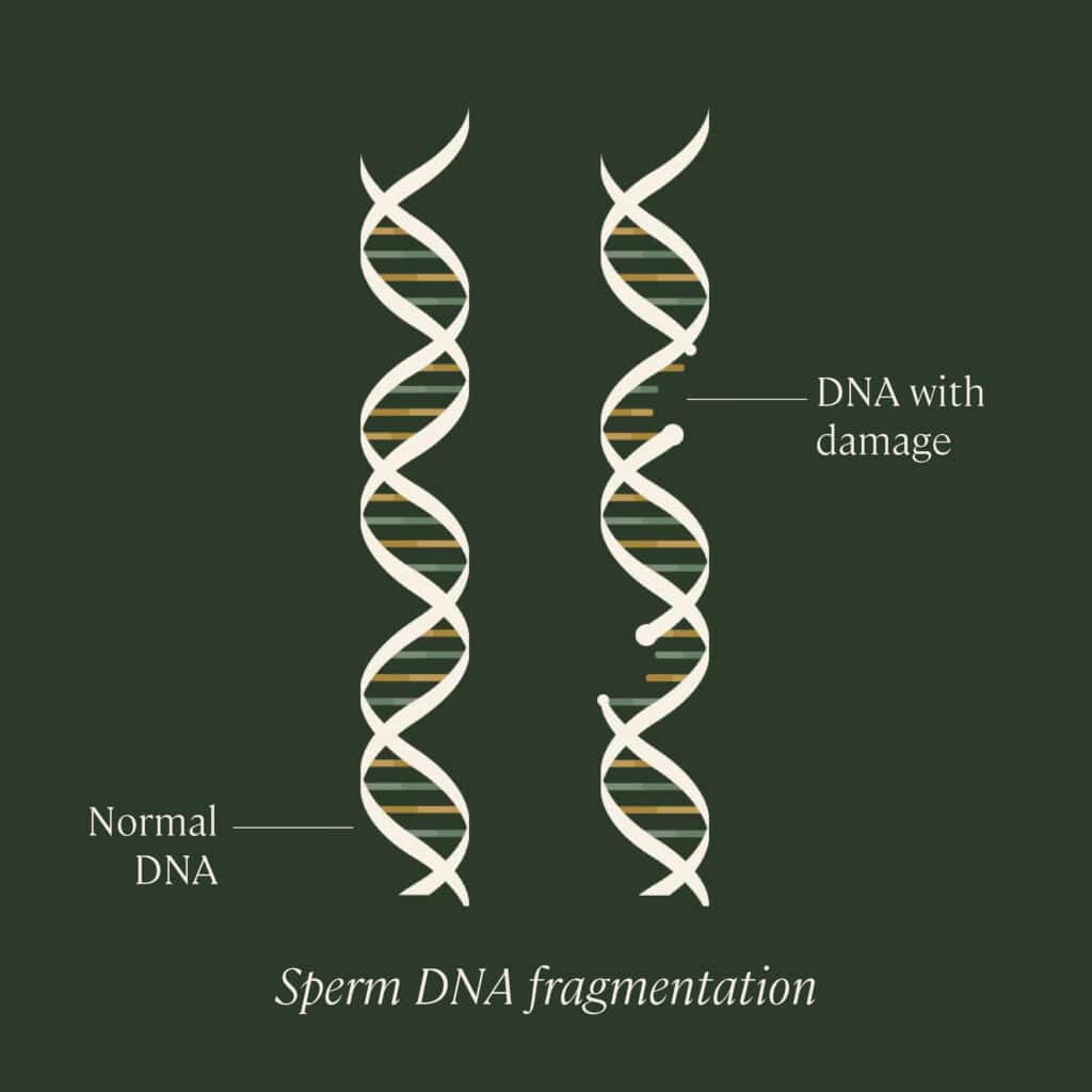 Guide to Sperm DNA Fragmentation & Testing | Legacy