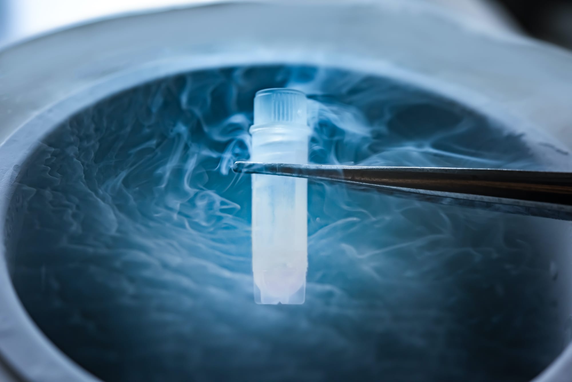 History Of Sperm Freezing At Home Sperm Freezing Legacy